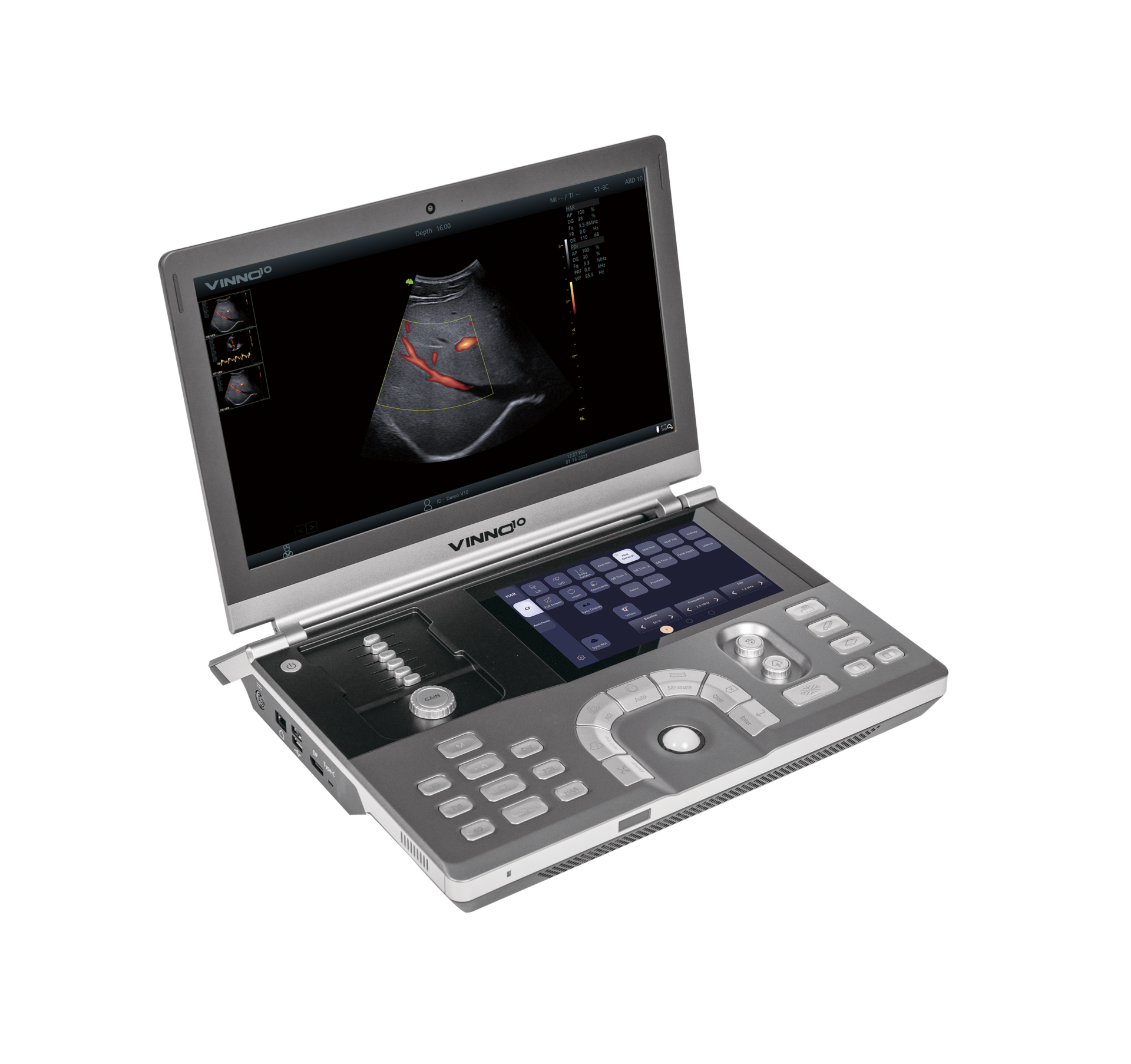 VINNO 10 - Ecógrafo de última generación - Vinno Spain