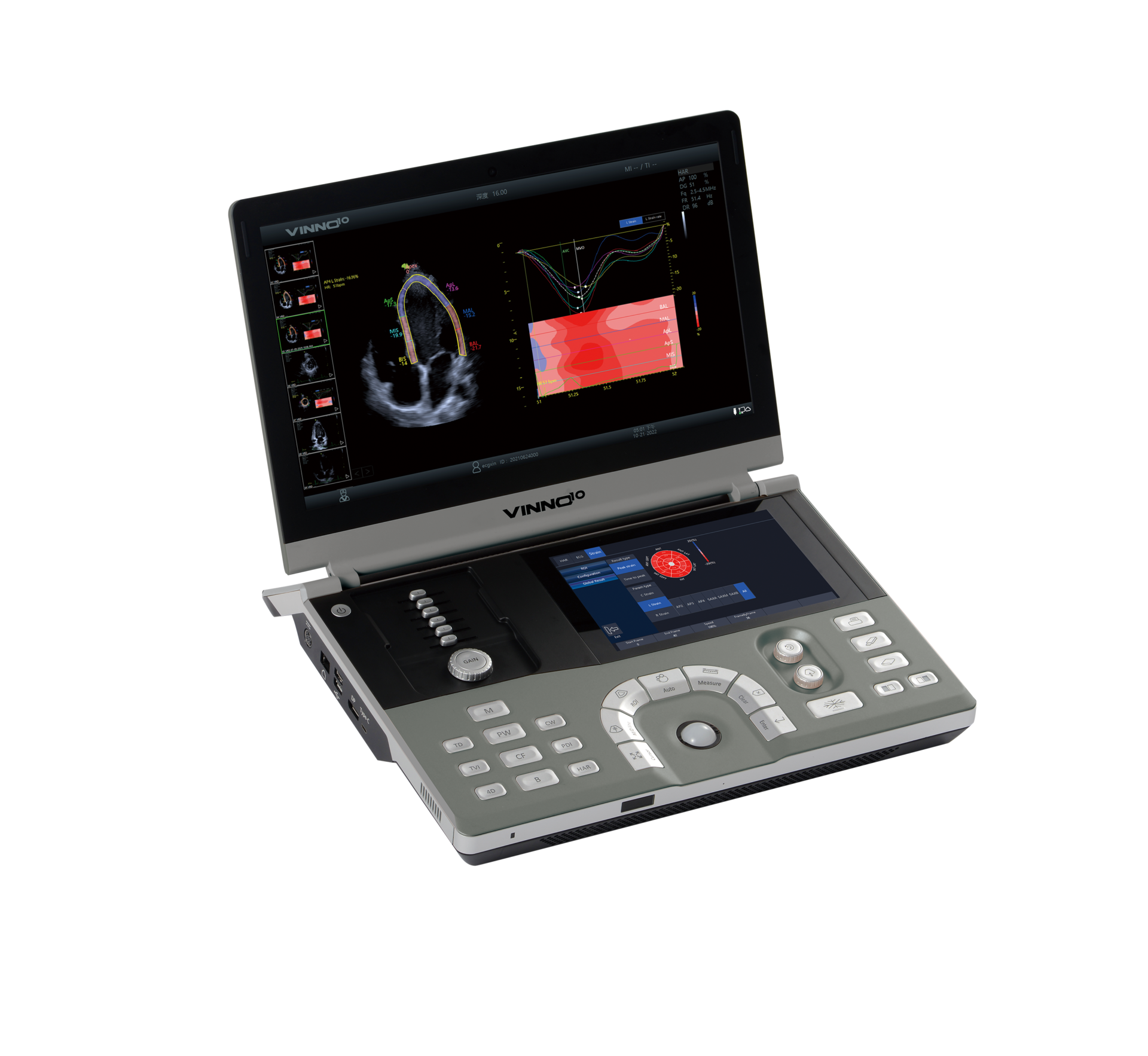 VINNO 10 - Ecógrafo de última generación - Vinno Spain